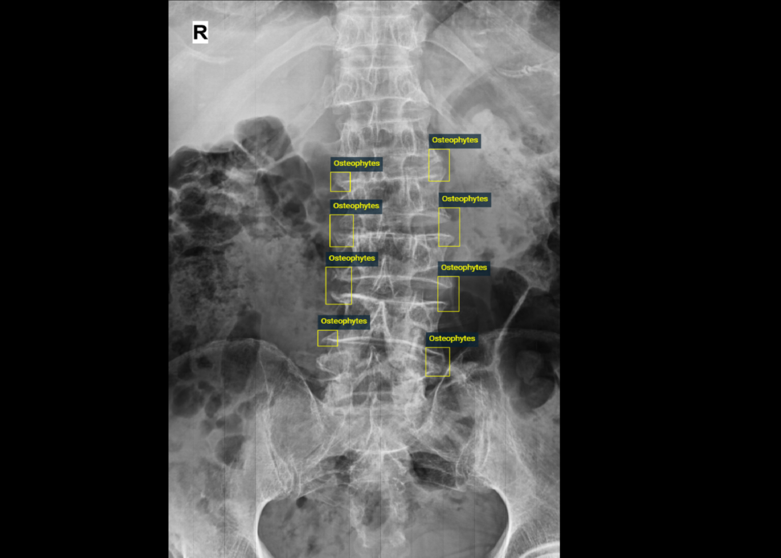 Public Datasets | VinLab