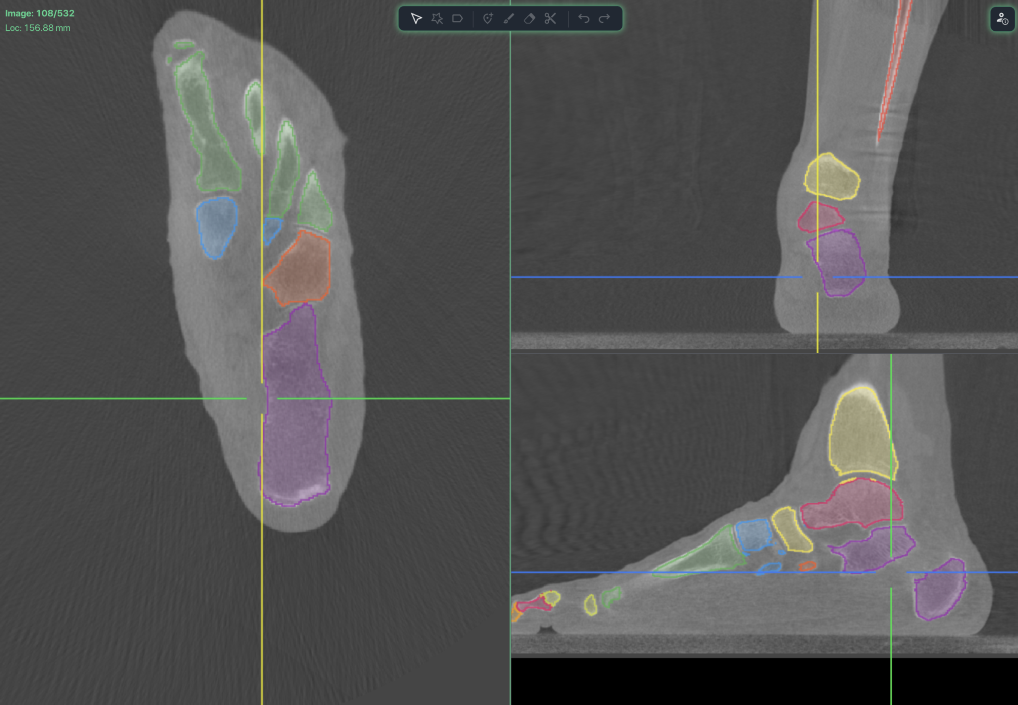 A Data Platform for Medical AI that enables building high-quality ...
