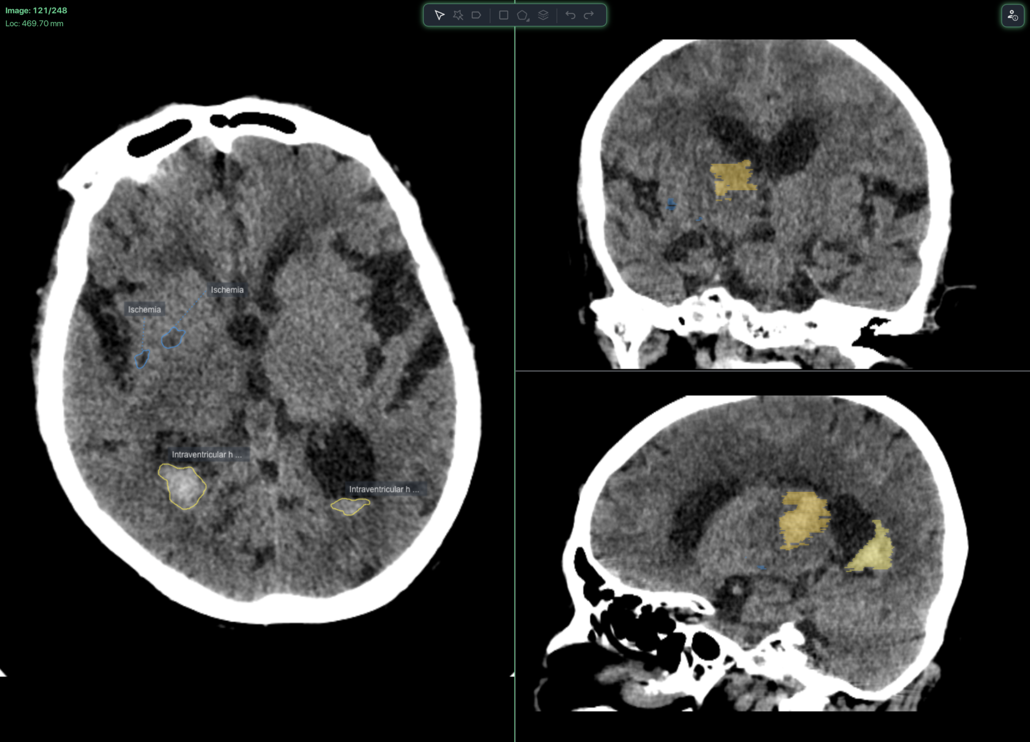 VinLab – Data solutions for medical imaging